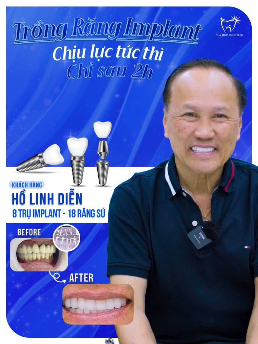 Khách Hàng - Nha Khoa Quốc Tế Sài Gòn